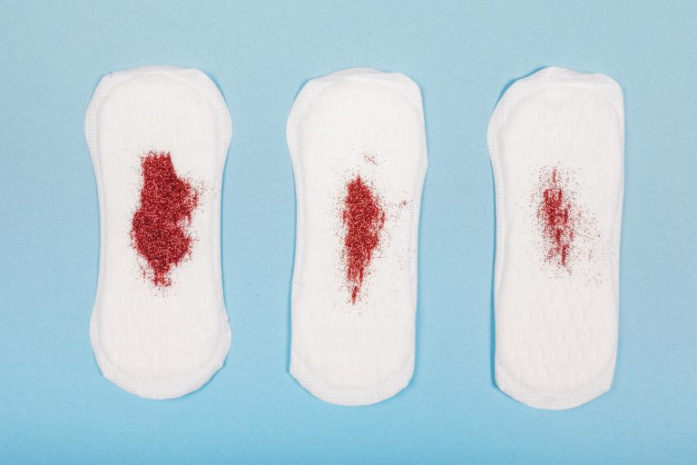 Coágulos na menstruação: Normal ou sinal de alerta? - Instituto Ana em ...